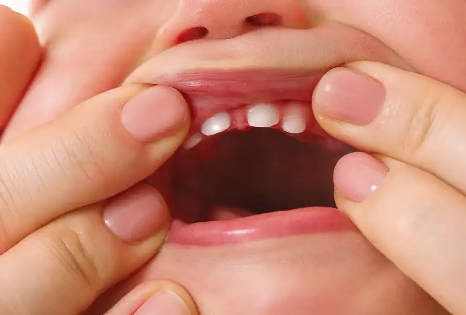 Tooth Eruption In Children Discovery Children S Dentistry